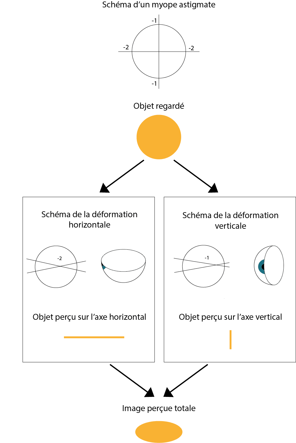 Tout savoir sur l'astigmatisme - Potentiel Vision